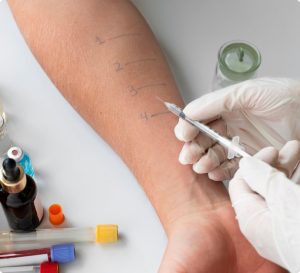 Pruebas Cutáneas para Alergia - Cayre